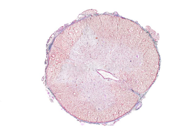 Spinal Cord and Motor Neuron Under the Microscope. Stock Image - Image ...