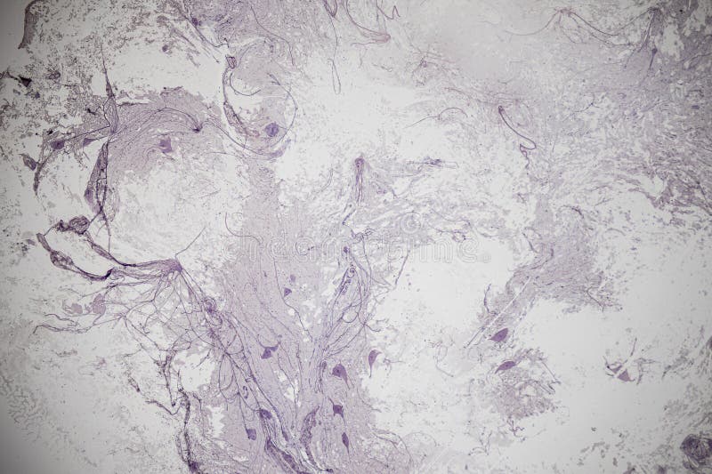 Motor Neuron, Spinal Cord, Nerve Fibres and Nerve Cells Under the ... Motor Neuron, Spinal Cord, Nerve Fibres and Nerve Cells Under the ...