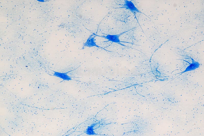 Motor Neuron Under the Microscope. Stock Image - Image of eosin ...