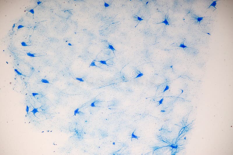 Motor Neuron Under the Microscope. Stock Photo - Image of matter, grey ...