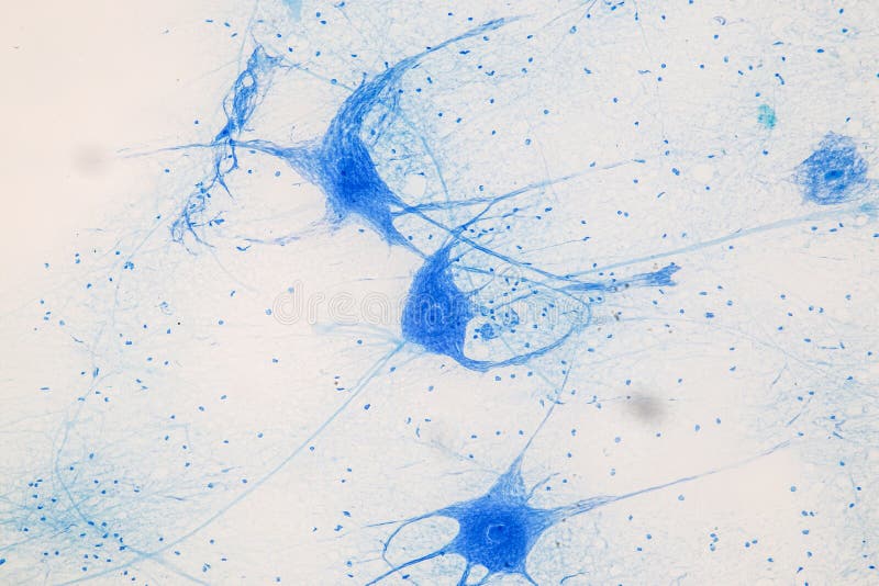 Motor Neuron Under the Microscope. Stock Photo - Image of education ...