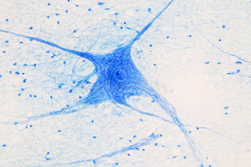 Motor Neuron Under the Microscope. Stock Image - Image of matter ...