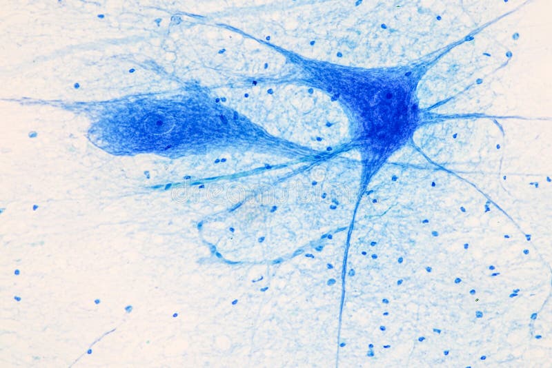 Multipolar Neuron Under Microscope