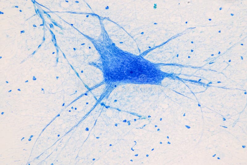 Motor Neuron 400x