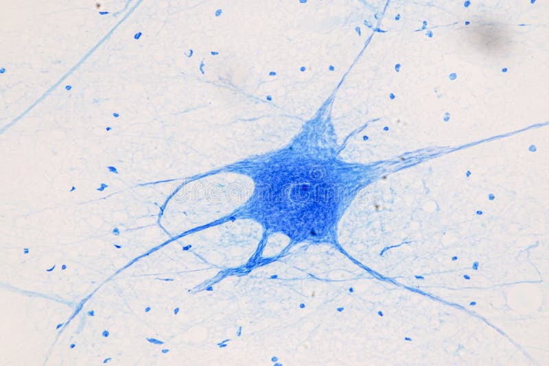 Motor Neuron Under the Microscope. Stock Photo - Image of cord ...