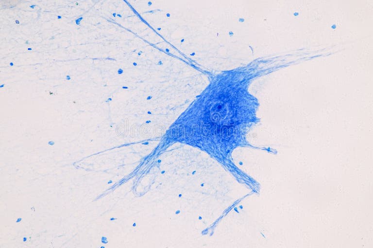 Motor Neuron Under the Microscope. Stock Photo - Image of microscopy ...