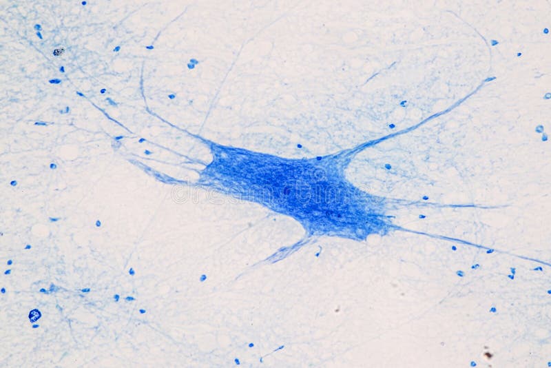 Motor Neuron Under the Microscope. Stock Image - Image of histology ...