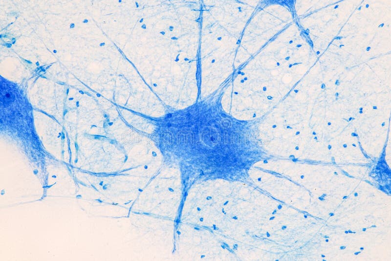 Motor Neuron and Nerve Cells Under the Microscope. Stock Photo - Image ...