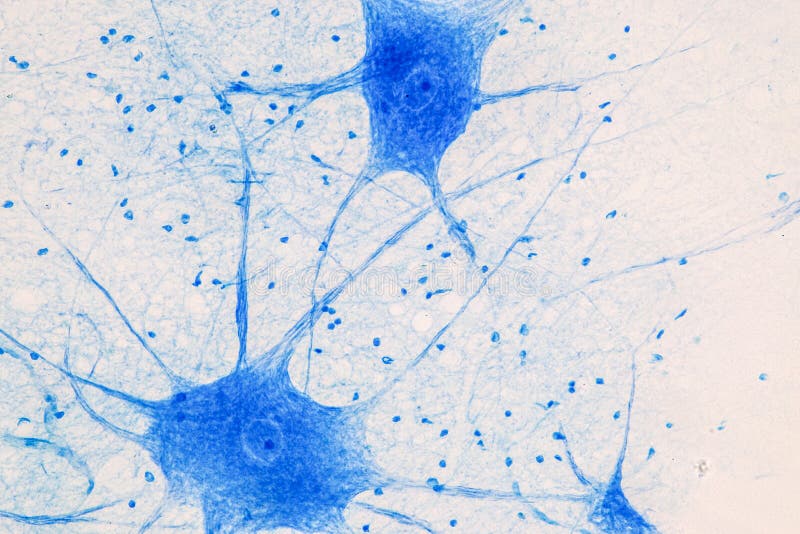Motor Neuron Under the Microscope. Stock Image - Image of labn, motor ...