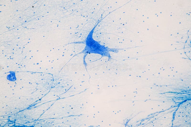 Motor Neuron Under the Microscope. Stock Photo - Image of matter ...