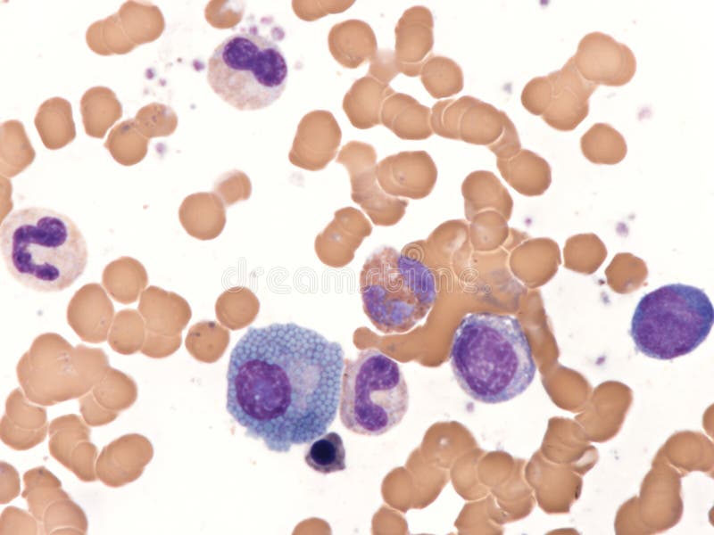 Plasmocytoma Stock Photos - Free & Royalty-Free Stock Photos from ...