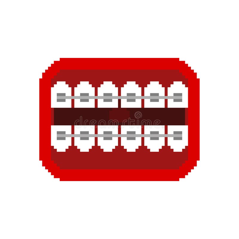 Mouth with Braces Pixel Art. 8 Bit Correction of Occlusion and Crooked ...