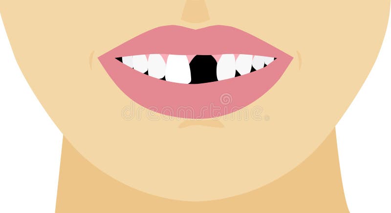 Mouth Toothless Cartoon Stock Illustrations – 141 Mouth Toothless ...