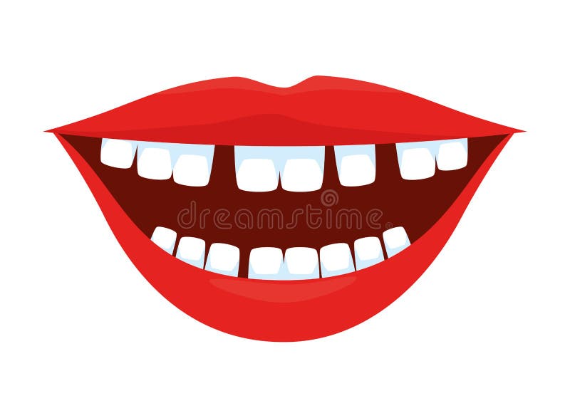 Mouth with comics teeth stock illustration. Illustration of caricature ...