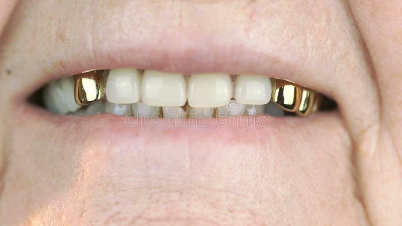 Mouth of Elderly Woman with False Teeth Stock Video - Video of mouth ...