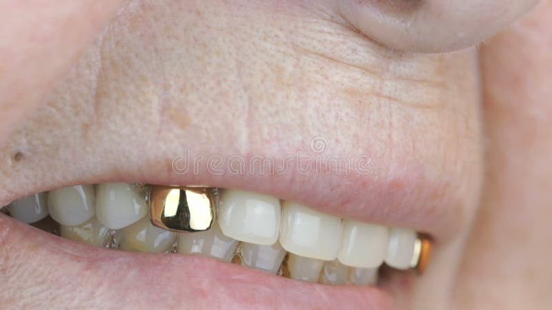 Mouth of Elderly Woman with False Teeth Stock Video - Video of mouth ...