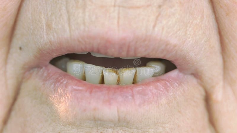 Mouth of Elderly Woman with False Teeth Stock Video - Video of mouth ...