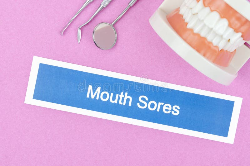 Mouth Sores Dental Disease and Teeth Model Stock Image - Image of ...