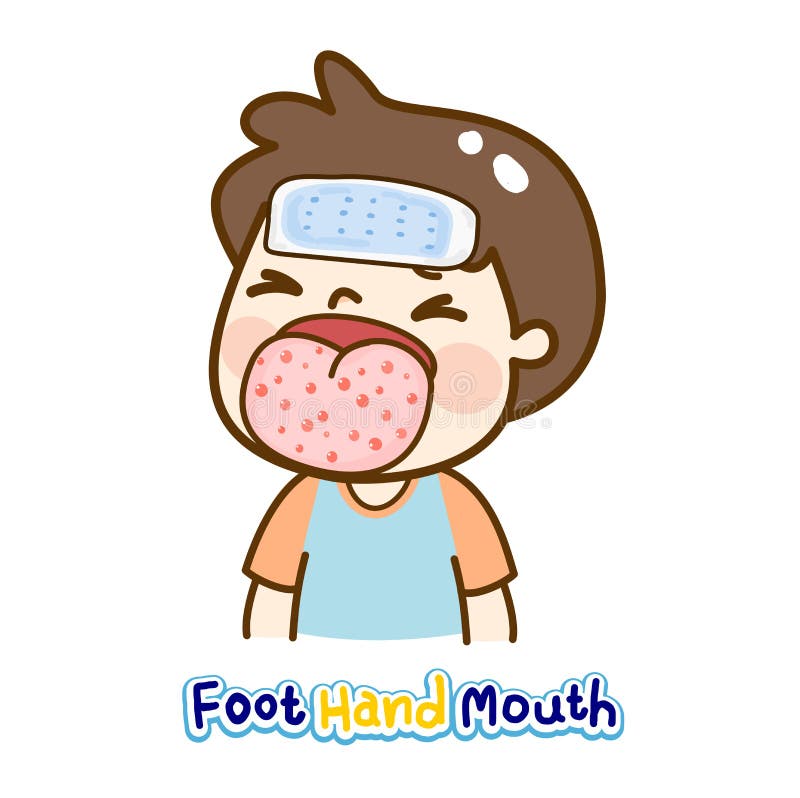 Mouth Ulcer Stock Illustrations – 581 Mouth Ulcer Stock Illustrations ...