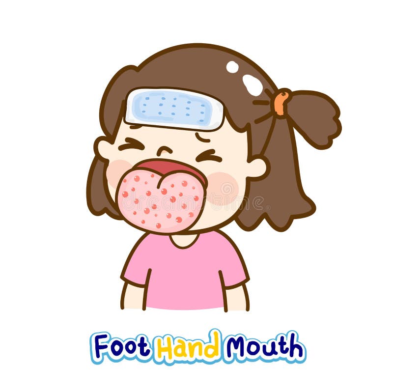 Mouth Ulcer Stock Illustrations – 581 Mouth Ulcer Stock Illustrations ...