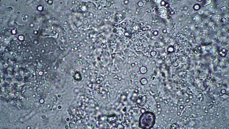 Bright Clumps of Lactic Acid Bacteria in Dairy Starter Culture Under ...