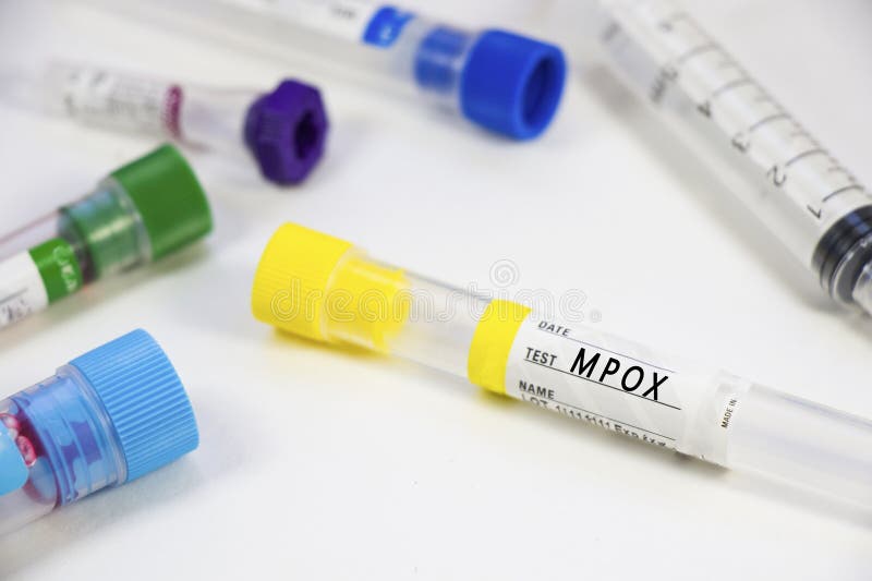 Mpox Blood Test Empty Tubes Samples on the White Background, Studio ...