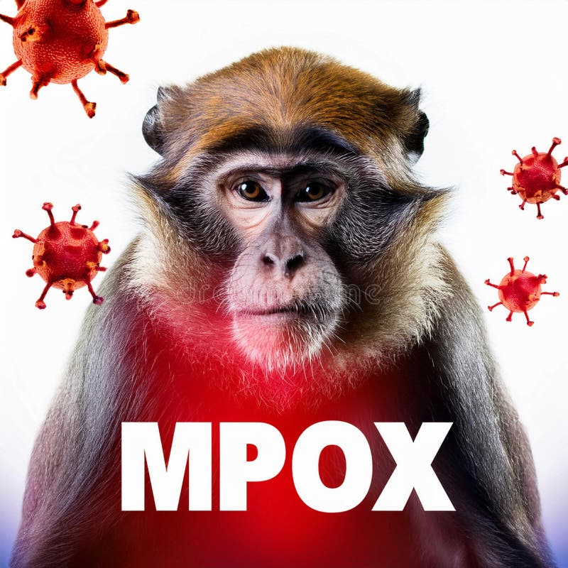 Mpox. Clade 1b. Monkeypox. Monkeypox Blisters on Arm. Virus, Epidemic, Disease. Generative AI ...