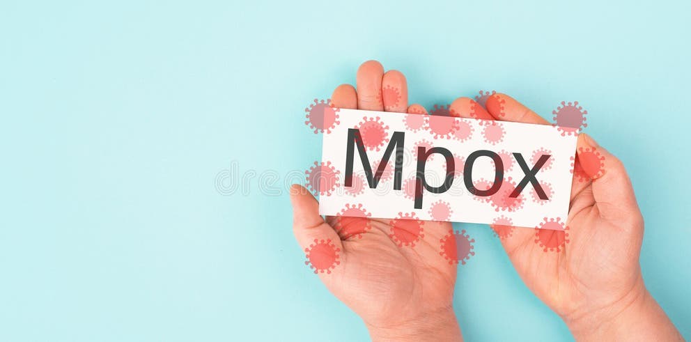 Mpox, Hands with Monkeypox Rash, Outbreak of the MPXV Virus, Infectious ...