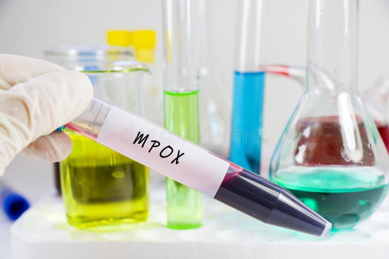 Mpox monkeypox virus stock photo. Image of infection - 331070682