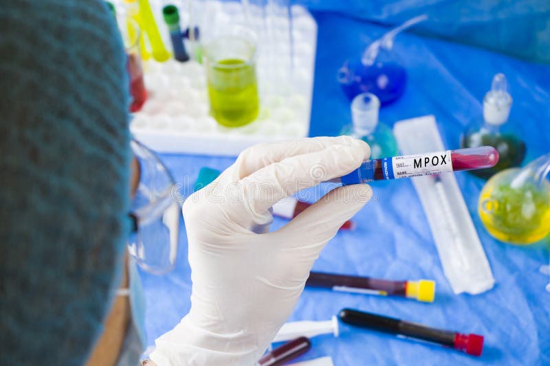 Mpox monkeypox virus stock photo. Image of zoonotic - 331070746