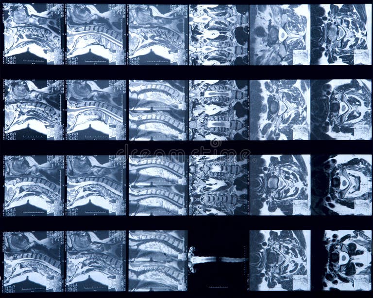 Mri stock image. Image of patient, people, scanner, backbone - 14107823
