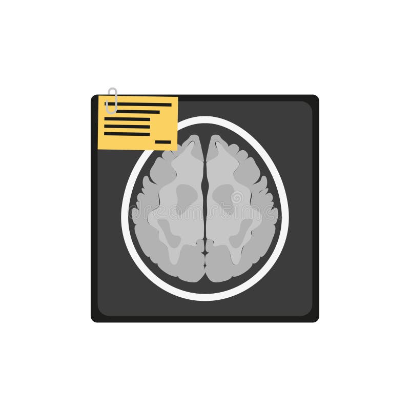 MRI of the Brain. Flat Icon with Black Brain for Medical Design Stock ...