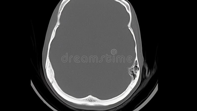 MRI Brain Scan Analysis: Examining Neural Structures and Potential ...