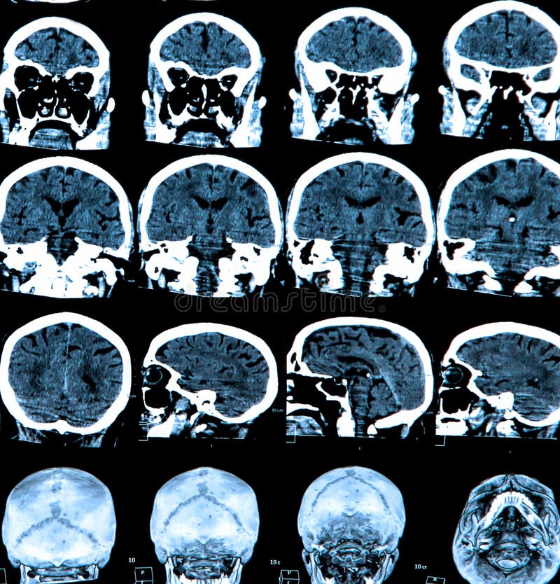 Lateral Profile Anatomy Eye Stock Photos - Free & Royalty-Free Stock ...