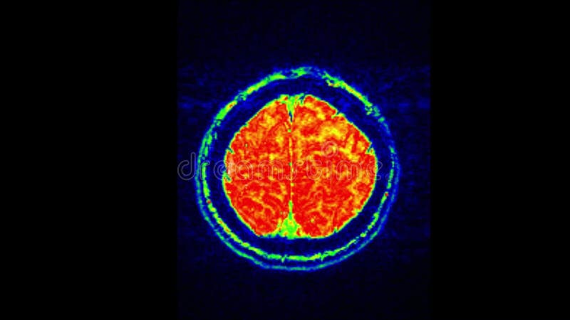 Mri Brain Scan Magnetic Resonance Image Ct Scan Of Human Brain In