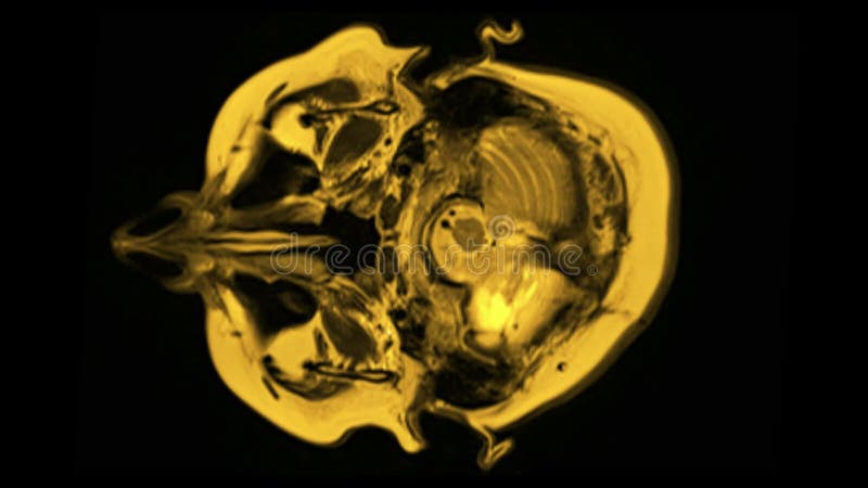 Human MRI Brain Scan on Black Background. Computed Tomography of the ...