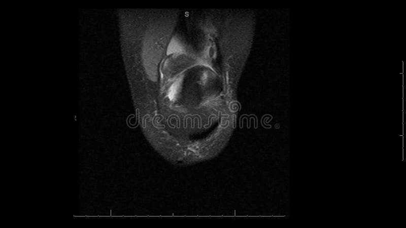 Mri Stock Footage & Videos - 5,824 Stock Videos