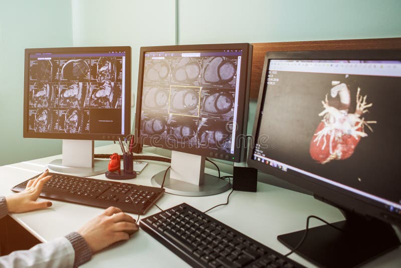 MRI CT Scanned Image Show on Computer in DataCenter Operation Room ...