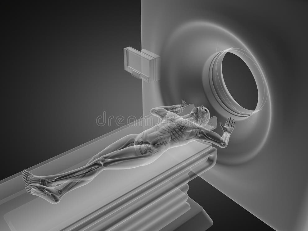 Mri Bones Stock Illustrations – 223 Mri Bones Stock Illustrations ...