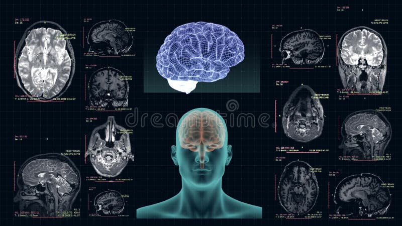 MRI of the Human Brain in the Different Projections Stock Footage ...