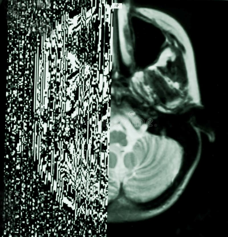 MRI Image error stock image. Image of camera, health - 22948755