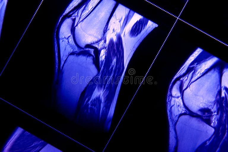 4,109 Mri Anatomy Clivus Stock Photos - Free & Royalty-Free Stock ...