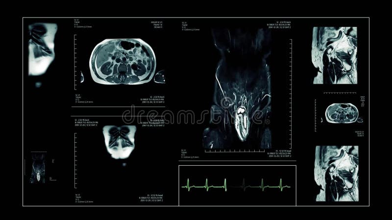 MRI live scan human body stock video. Video of scan - 118913279