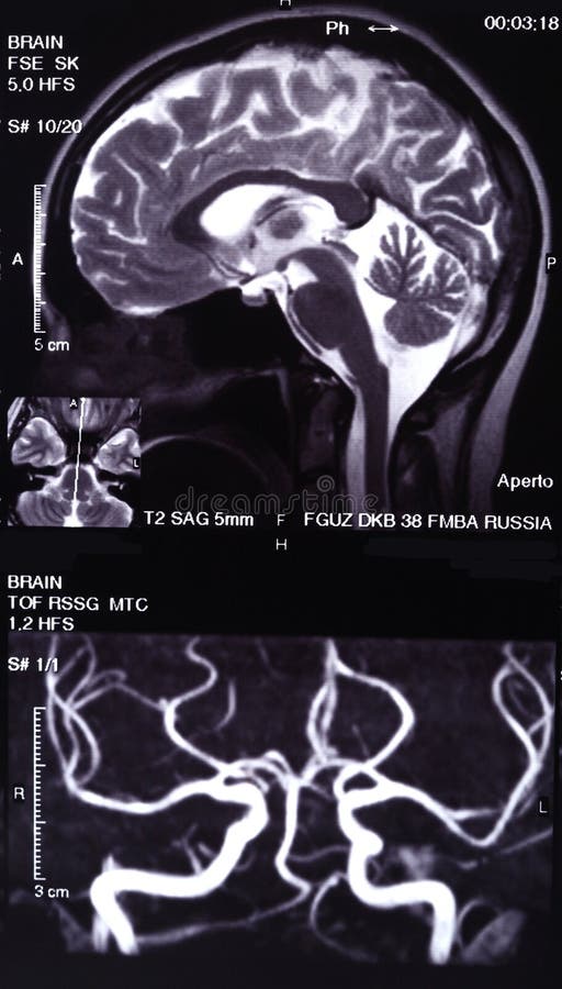 MRI and MR angiography stock photo. Image of image, equipment - 16741896
