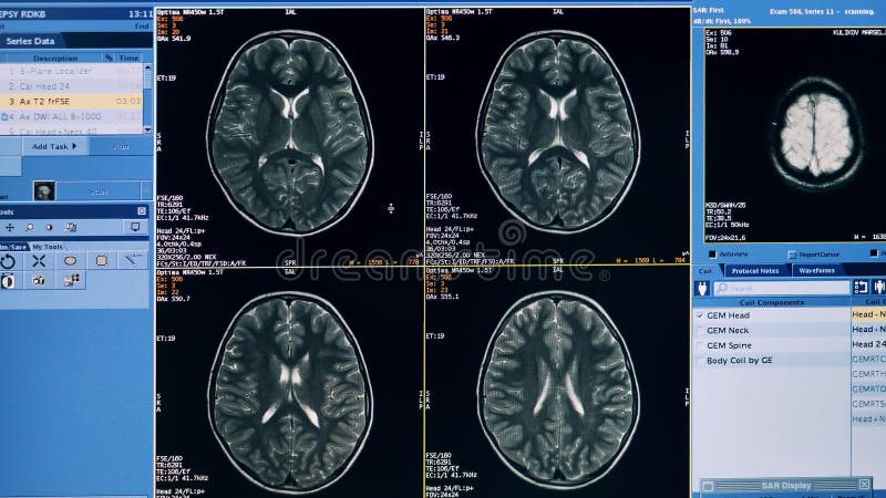 MRI Brain Scanning Animation. Neurology Data, Vital Signs on Display ...