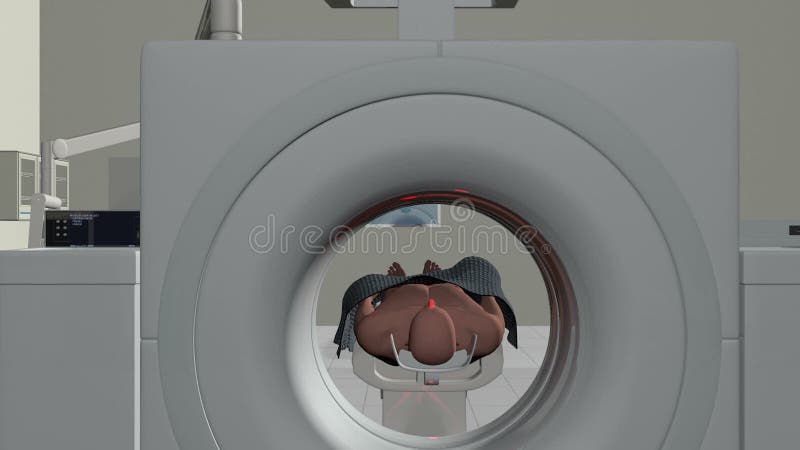 MRI Scan, Camera Fly from Brain Scan, Stock Footage Stock Video Footage ...