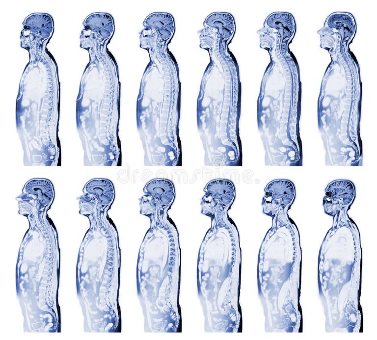 MRI scan stock photo. Image of radiologist, coccygeal - 34800550