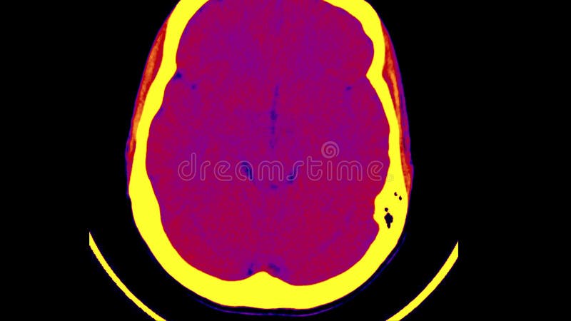 MRI Scan of the Human Brain: Analyzing Structural Features and ...