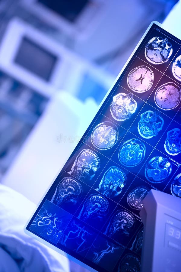 MRI Scan of Human Brain in the Hospital Ward Stock Image - Image of ...