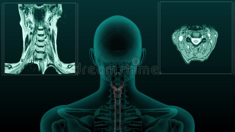 X-ray Scan of the Human Head and Neck with the Larynx Visible. 3d ...